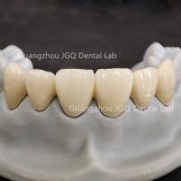 China Custom Layered Zirconia Perfect Shade Matching for Front Teeth Cosmetics for sale