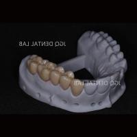 China 3Shape CAD CAM Bulk Zirconia Precision Marginal Fit China Leading Lab for sale