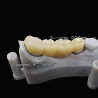 China High Strength Monolithic Zirconia Stable Restoration Competitive Prices China Dental Lab for sale