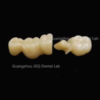 China Medical Grade Zirconia Restorations International Certification Standards for Permanent Clinical Use for sale