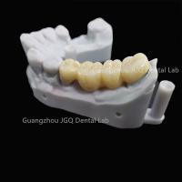 China Medical Grade Zirconia Restorations International Certification Standards for Permanent Clinical Use for sale