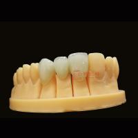 China Natural Translucent Zirconia Restorations Custom Designed For Anterior Teeth for sale