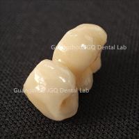 China Fracture Proof Zirconia Structure Durable Posterior Dental Restoration for sale