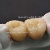 China Fracture Proof Zirconia Structure Durable Posterior Dental Restoration for sale