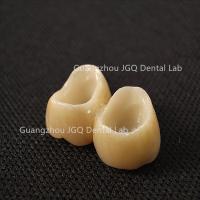 China Fracture Proof Zirconia Structure Durable Posterior Dental Restoration for sale