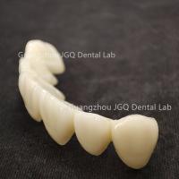 China Natural Translucent Zirconia Restorations Custom Designed For Anterior Teeth for sale