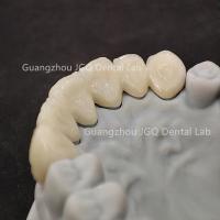 China Natural Translucent Zirconia Restorations Custom Designed For Anterior Teeth for sale