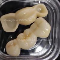 China High Toughness Zirconia For Heavy Occlusion And Bruxism Protection for sale