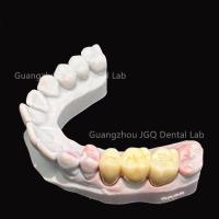 China Advanced Digital Zirconia Production Strict Multi Stage Quality Inspection for sale