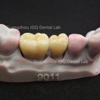 China Advanced Digital Zirconia Production Strict Multi Stage Quality Inspection for sale