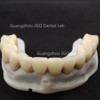 China High Strength Monolithic Bulk Zirconia Durable Restoration Solution China Leading Lab for sale