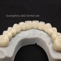 China 3Shape Digital Workflow Zirconia Precise Occlusal Alignment Technology JGQ Dental Lab Custom Zirconia Restoration for sale