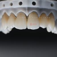 China Medical Zirconia Crown Bridge CNC Milled Layered Aesthetic Fast Turnaround FDA CE Certified for sale