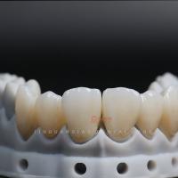 China Medical Zirconia Crown Bridge CNC Milled Layered Aesthetic Fast Turnaround FDA CE Certified for sale