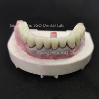 China High Strength Monolithic Bulk Zirconia Durable Restoration Solution China Leading Lab for sale