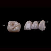 China Natural Translucent Zirconia Restorations Custom Designed For Anterior Teeth for sale