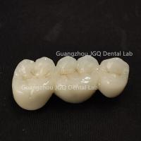 China Hypoallergenic Zirconia Crown Bridge For Permanent Dental Implants for sale
