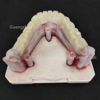 China 3Shape CAD/CAM Aesthetic Layered Monolithic Bulk Zirconia Customizable to Your Needs for sale