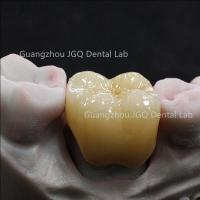 China 3Shape CAD/CAM Aesthetic Layered Monolithic Bulk Zirconia Customizable to Your Needs for sale