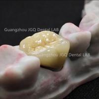 China Bruxism Suitable Zirconia Crown Bridge High Strength CNC Lab Fabrication for sale