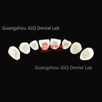 China Customized Chinese Dental Lab Zirconia Teeth Precision Overall Dental Restoration for sale