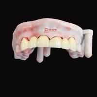 China Fully Glazed Polished Zirconia Low Plaque Accumulation Protect Opposing Teeth for sale