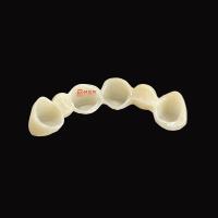 China Fully Glazed Polished Zirconia Low Plaque Accumulation Protect Opposing Teeth for sale