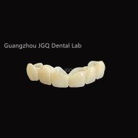 China Dental Lab China High Esthetics Full Contour Crown Dental Zirconia Bridge for sale