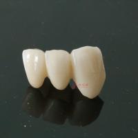 China Bruxism Suitable Zirconia Crown Bridge High Strength CNC Lab Fabrication for sale
