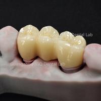 China Long Lasting Zirconia Crown Bridge Precise Margin Adaptation for Dental Restoration for sale