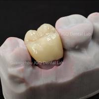 China High Fracture Resistant Zirconia Crown Bridge CNC For Bruxism Heavy Occlusion for sale