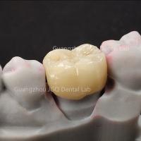 China High Fracture Resistant Zirconia Crown Bridge CNC For Bruxism Heavy Occlusion for sale