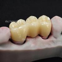 China Custom Zirconia Restorations Professional Dental Lab for Global Dental Clinics for sale