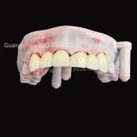 China Aesthetic Zirconia Crown Bridge Natural Translucency for Anterior Smile Restoration for sale