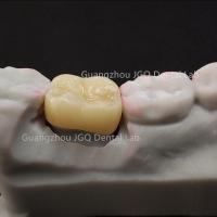 China Custom Zirconia Restorations Professional Dental Lab for Global Dental Clinics for sale