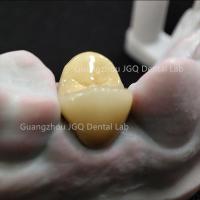 China Custom Zirconia Restorations Professional Dental Lab for Global Dental Clinics for sale