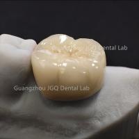 China Custom Zirconia Restorations Professional Dental Lab for Global Dental Clinics for sale