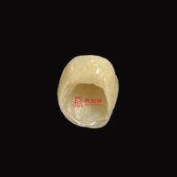 China Custom China Dental Lab Zirconia Crown Bridge for All Oral Conditions for sale