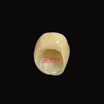 China Custom China Dental Lab Zirconia Crown Bridge for All Oral Conditions for sale