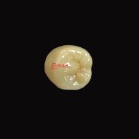 China Custom China Dental Lab Zirconia Crown Bridge for All Oral Conditions for sale