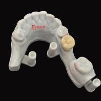 China Custom China Dental Lab Zirconia Crown Bridge for All Oral Conditions for sale