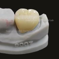 China Custom Zirconia Crown Bridge Certified Dental Lab Full Range Dental Restoration Services for sale