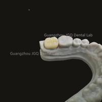 China Custom Zirconia Crown Bridge Certified Dental Lab Full Range Dental Restoration Services for sale