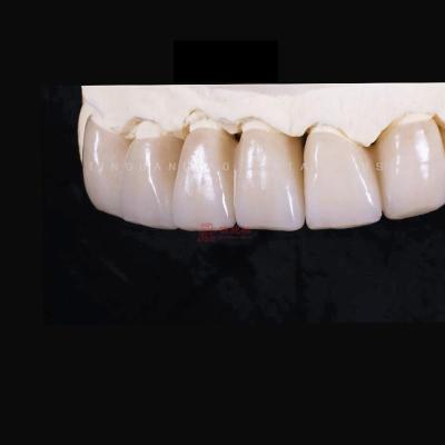 China Aesthetic Zirconia Crown Bridge Natural Translucency for Anterior Smile Restoration for sale