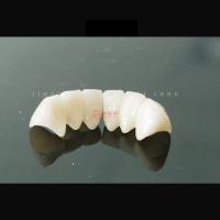 China Cobalt Chrome Alloy Porcelain Fused To Metal Crown Pfm Tooth Crowns for sale