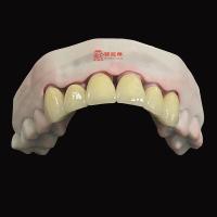 China Guangzhou Dental Lab | Custom CNC Milled Zirconia Crowns High Strength Certified for sale