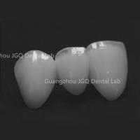 China Custom Layered Zirconia Perfect Shade Matching for Front Teeth Cosmetics for sale