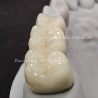 China Custom China Dental Laboratory Zirconia Crown Bridge for Global Clinics for sale