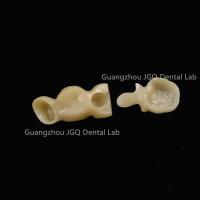 China Dual Zirconia Crown Bridge Precision Crafted By China Dental Lab for sale