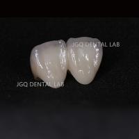 China Custom Layered Zirconia Perfect Shade Matching for Front Teeth Cosmetics for sale